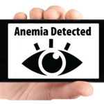 IU cancer patients to test Purdue smartphone app for anemia detection ...
