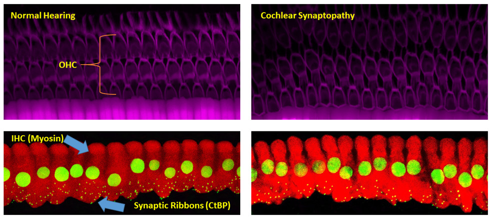 Research Interests - Auditory Neurophysiology and Modeling Lab - Purdue ...