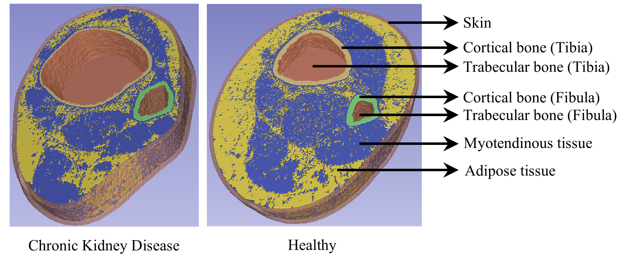Research - Quantitative Biomedical Imaging and Spectroscopy Lab ...